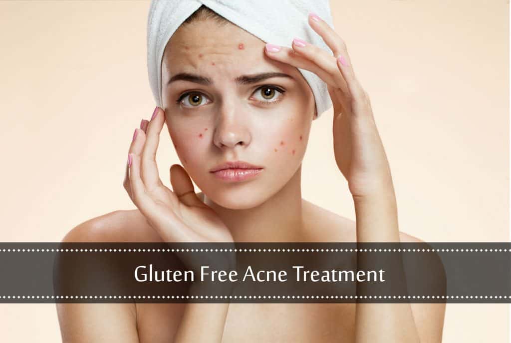 Gluten-Free Acne Treatment – The Celiac Diva